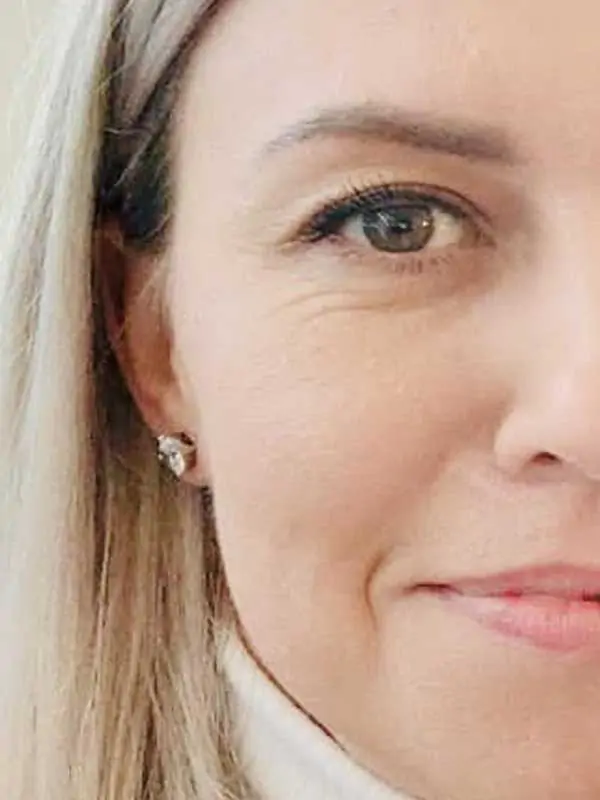 Before/after - Bloom Clinique